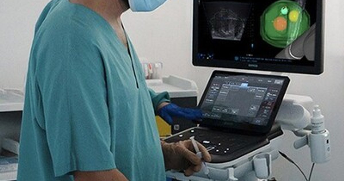 Esaote's AI Maps Future of Prostate Cancer Diagnosis at EAU 2026 ...